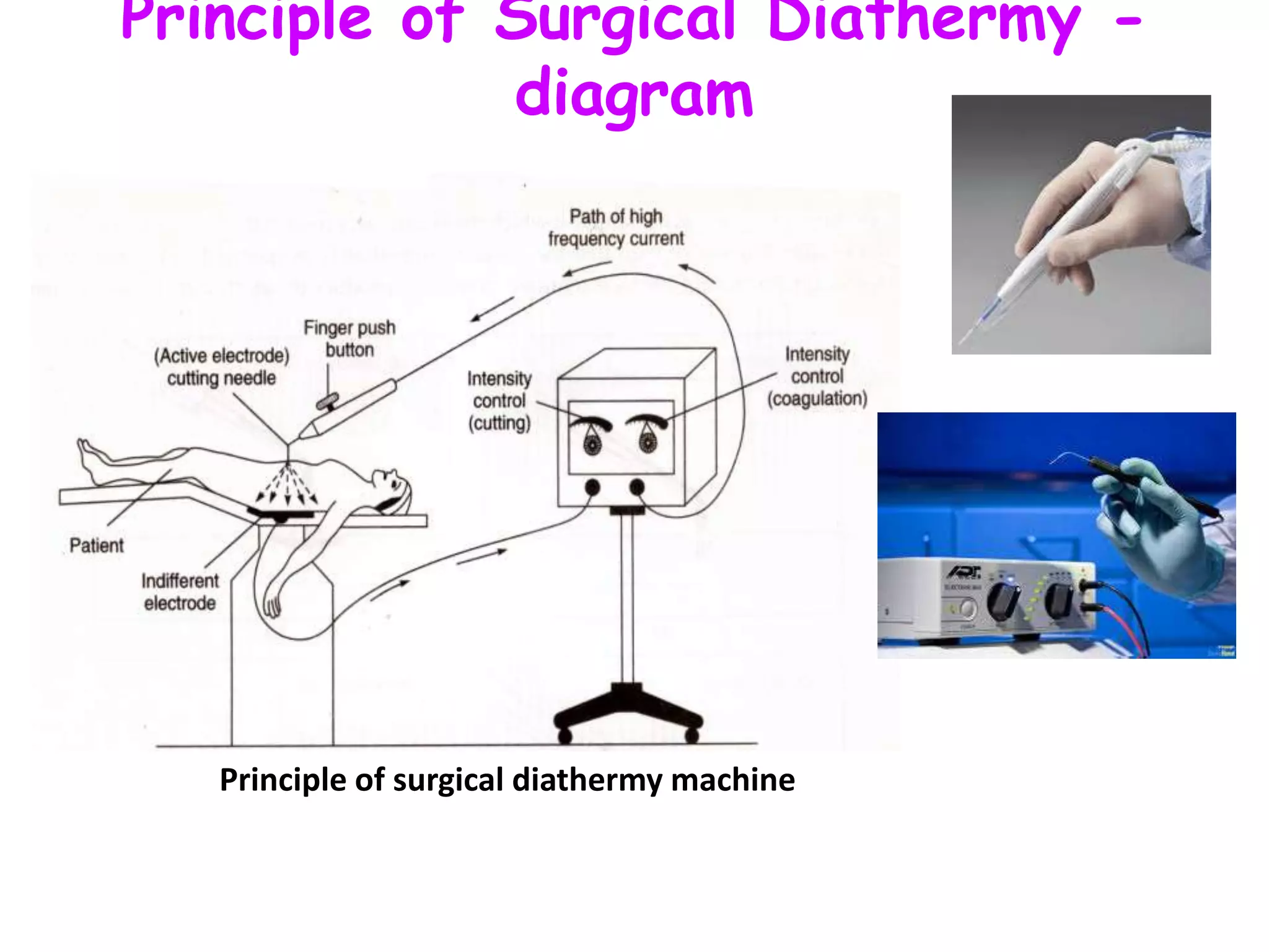 Surgical diathermy | PPTX