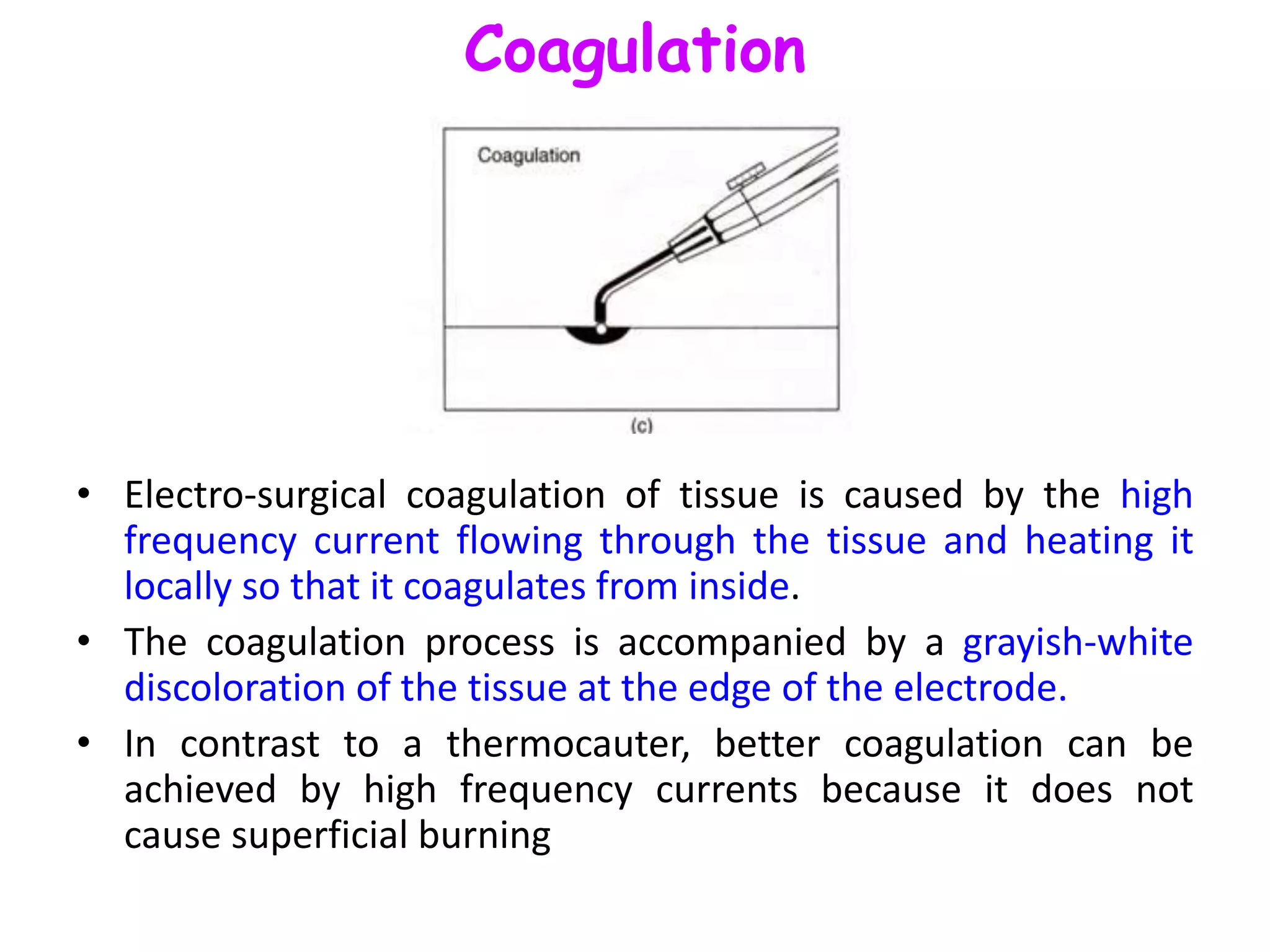 Surgical diathermy | PPTX
