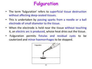 Surgical diathermy | PPTX