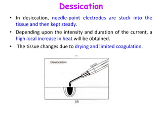Surgical diathermy | PPTX
