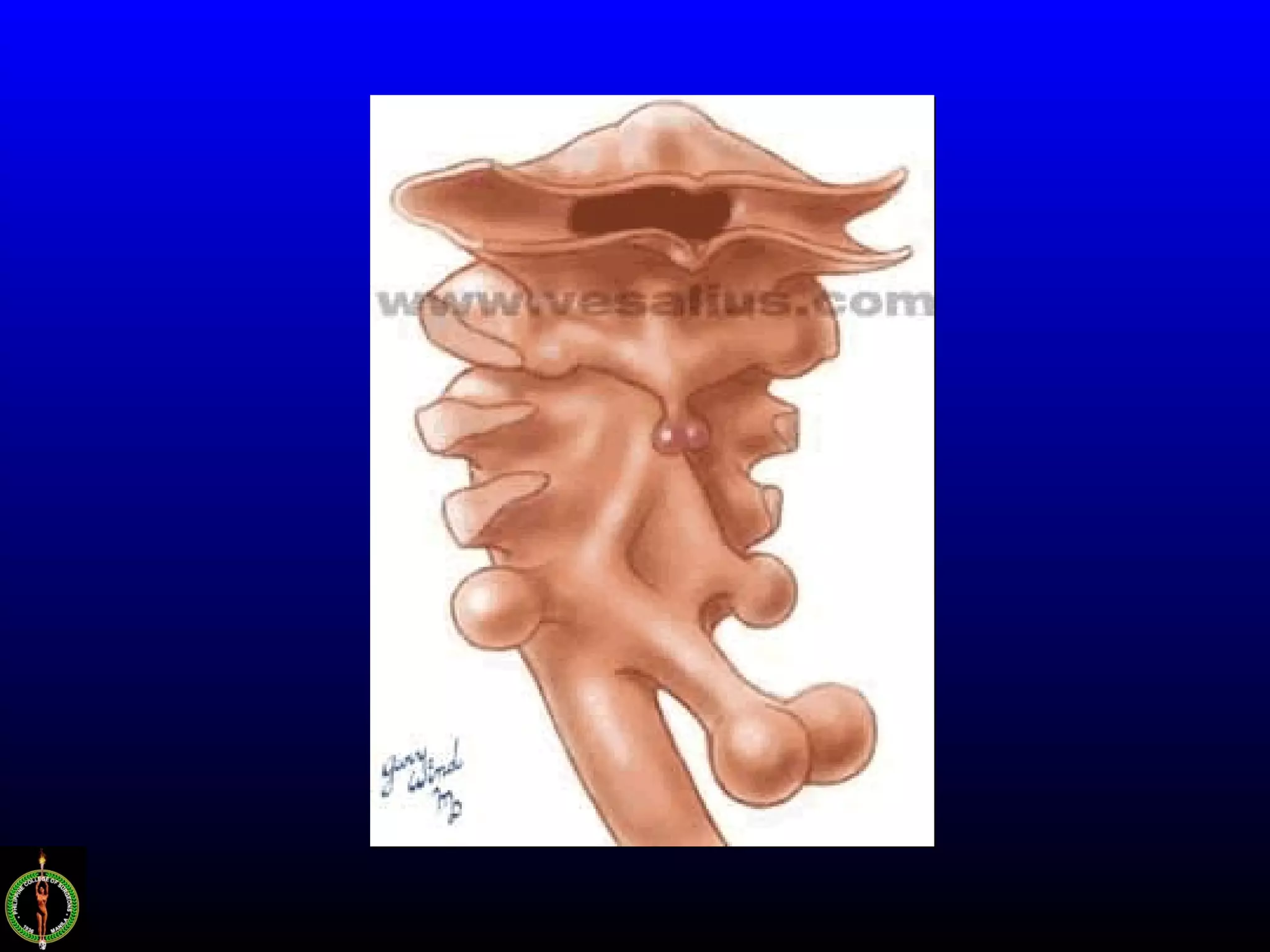 Surgical diseases of the parathyroid gland/reupload | PPT