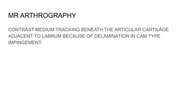 SURGICAL DISLOCATION OF HIP:GANZ APPROACH, KOCHER LANGENBACK,GIBSON ...