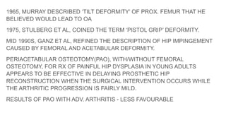 SURGICAL DISLOCATION OF HIP:GANZ APPROACH, KOCHER LANGENBACK,GIBSON ...