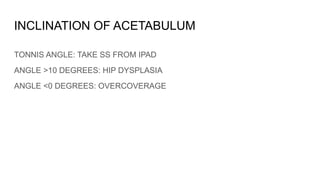 SURGICAL DISLOCATION OF HIP:GANZ APPROACH, KOCHER LANGENBACK,GIBSON ...