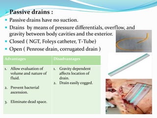 Surgical drains | PPTX