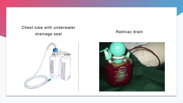 Surgical Drains.pptx