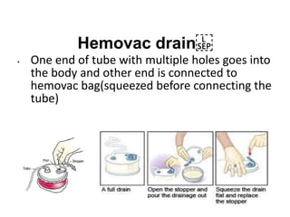 Most Common Drains used in general surgery | PPT