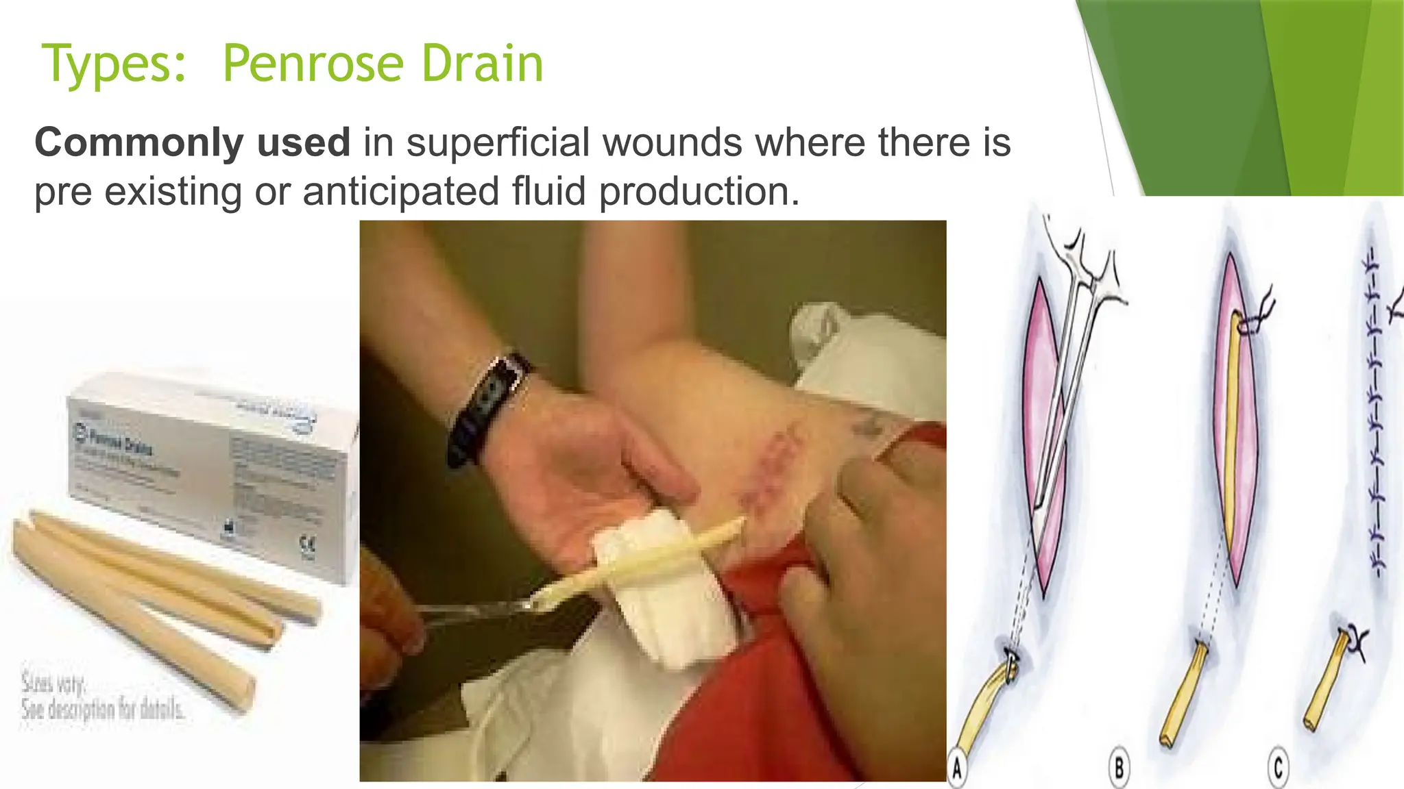 SURGICAL DRAINS & ITS MANAGEMENT.pptx