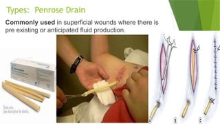 SURGICAL DRAINS & ITS MANAGEMENT.pptx
