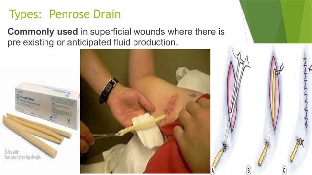 SURGICAL DRAINS & ITS MANAGEMENT.pptx