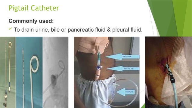 SURGICAL DRAINS & ITS MANAGEMENT.pptx