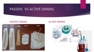 Surgical drains | PPT