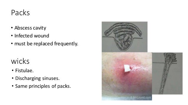 Surgicaldrainsand their types