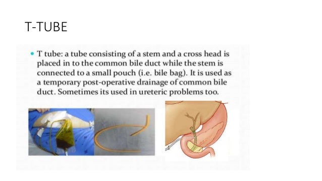 Surgicaldrainsand their types
