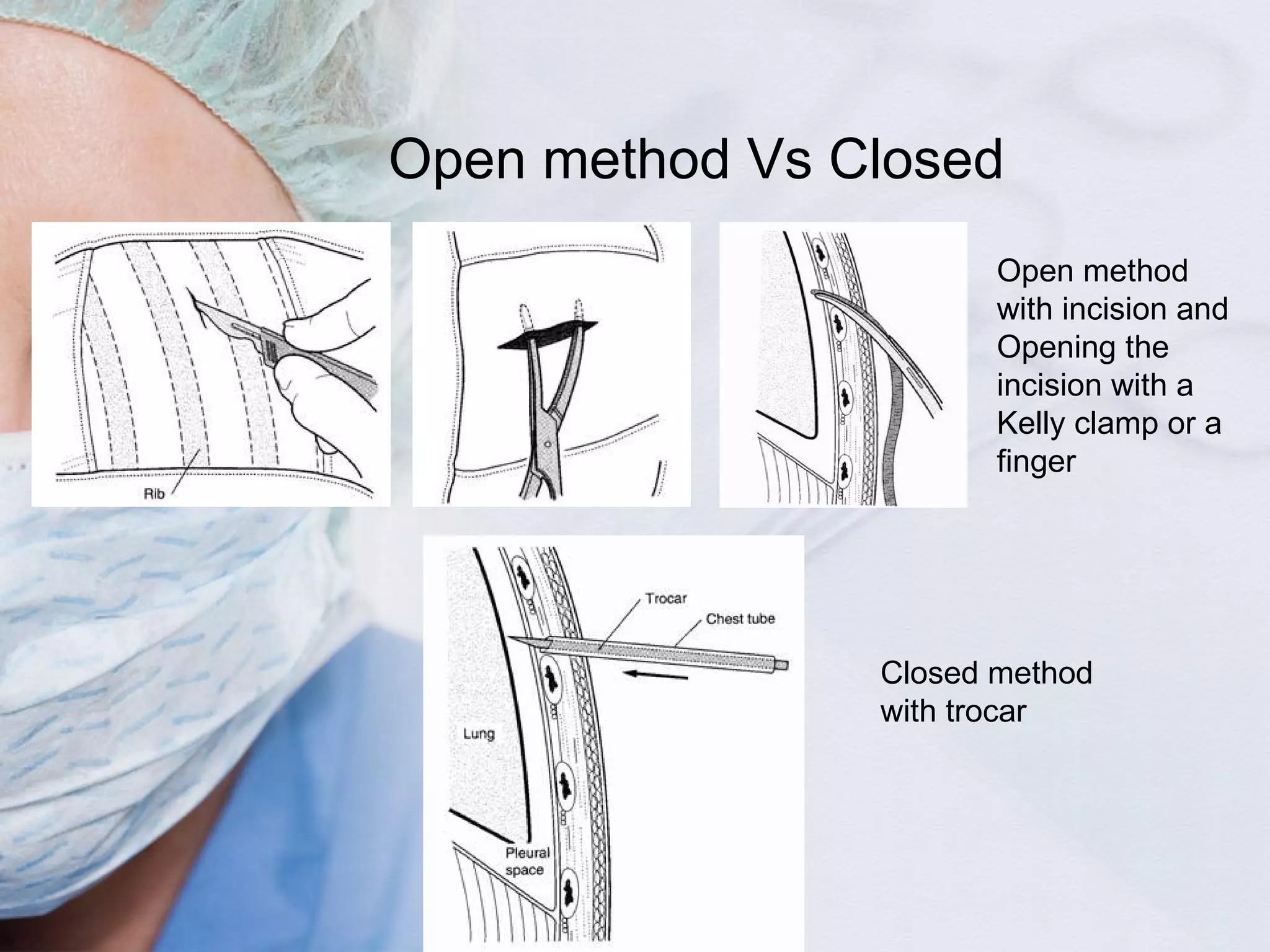 Surgical drains, tube, catheters and central lines | PPT