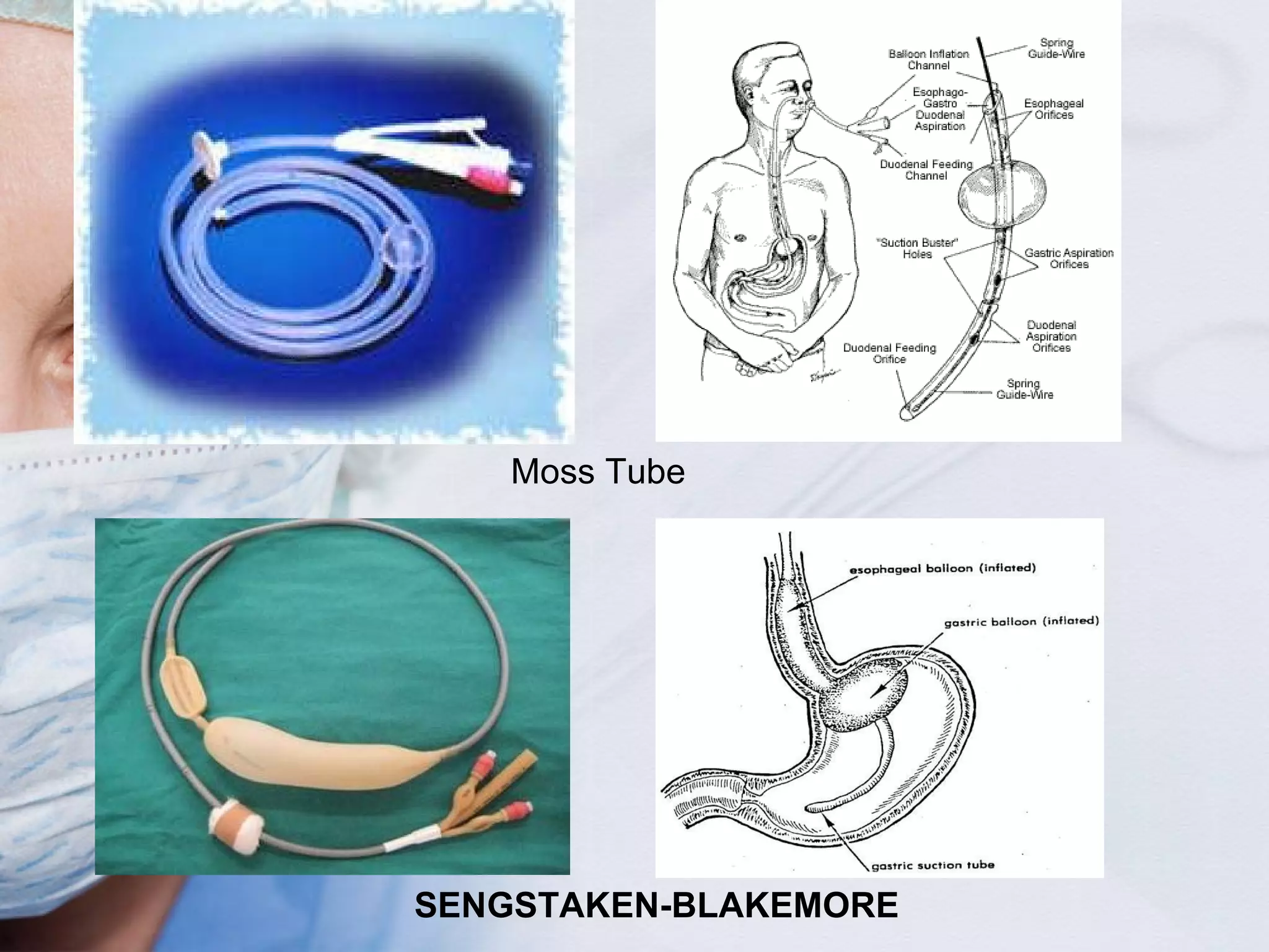 Surgical drains, tube, catheters and central lines | PPT