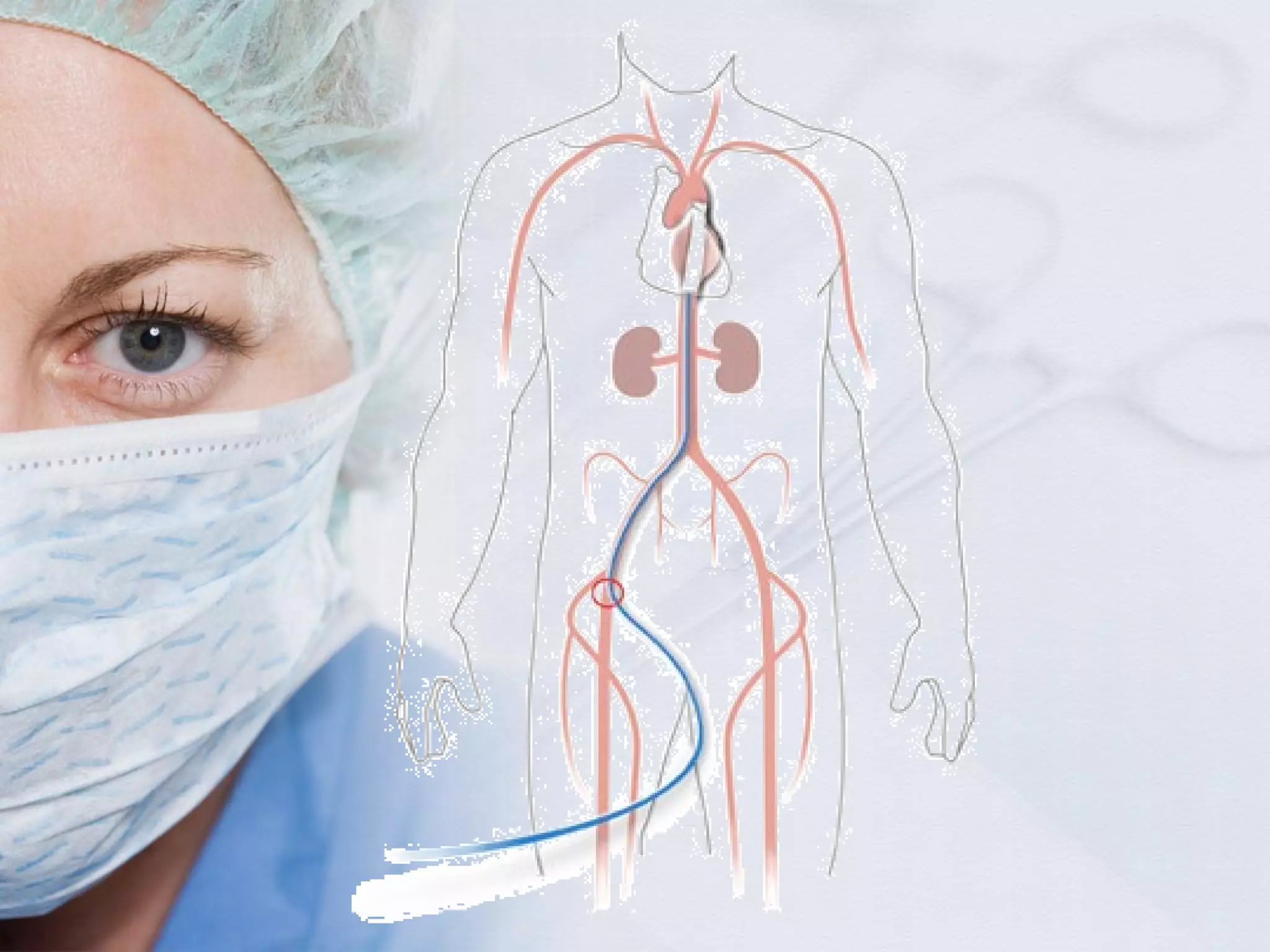 Surgical drains, tube, catheters and central lines | PPT