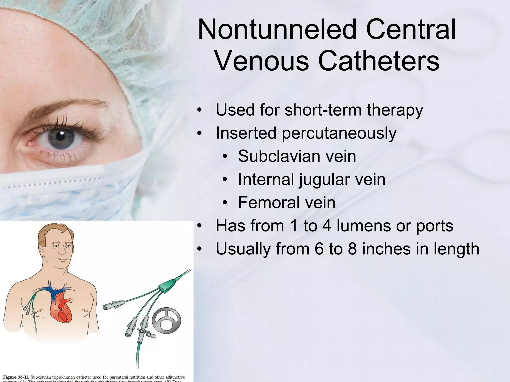 Surgical drains, tube, catheters and central lines | PPT