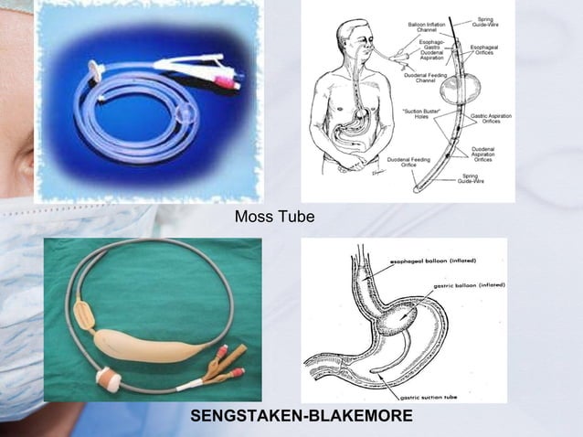 Surgical drains, tube, catheters and central lines | PPT