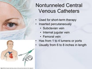 Surgical drains, tube, catheters and central lines | PPT