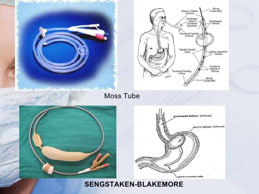 Surgical drains, tube, catheters and central lines
