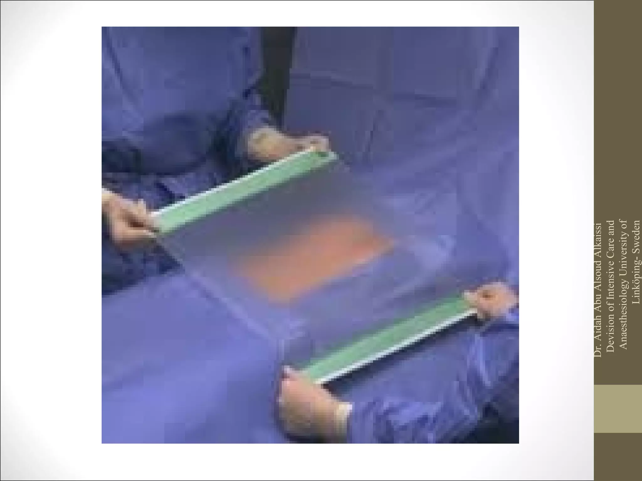 Surgical draping | PPT