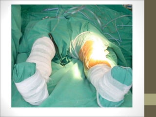 Surgical draping | PPT