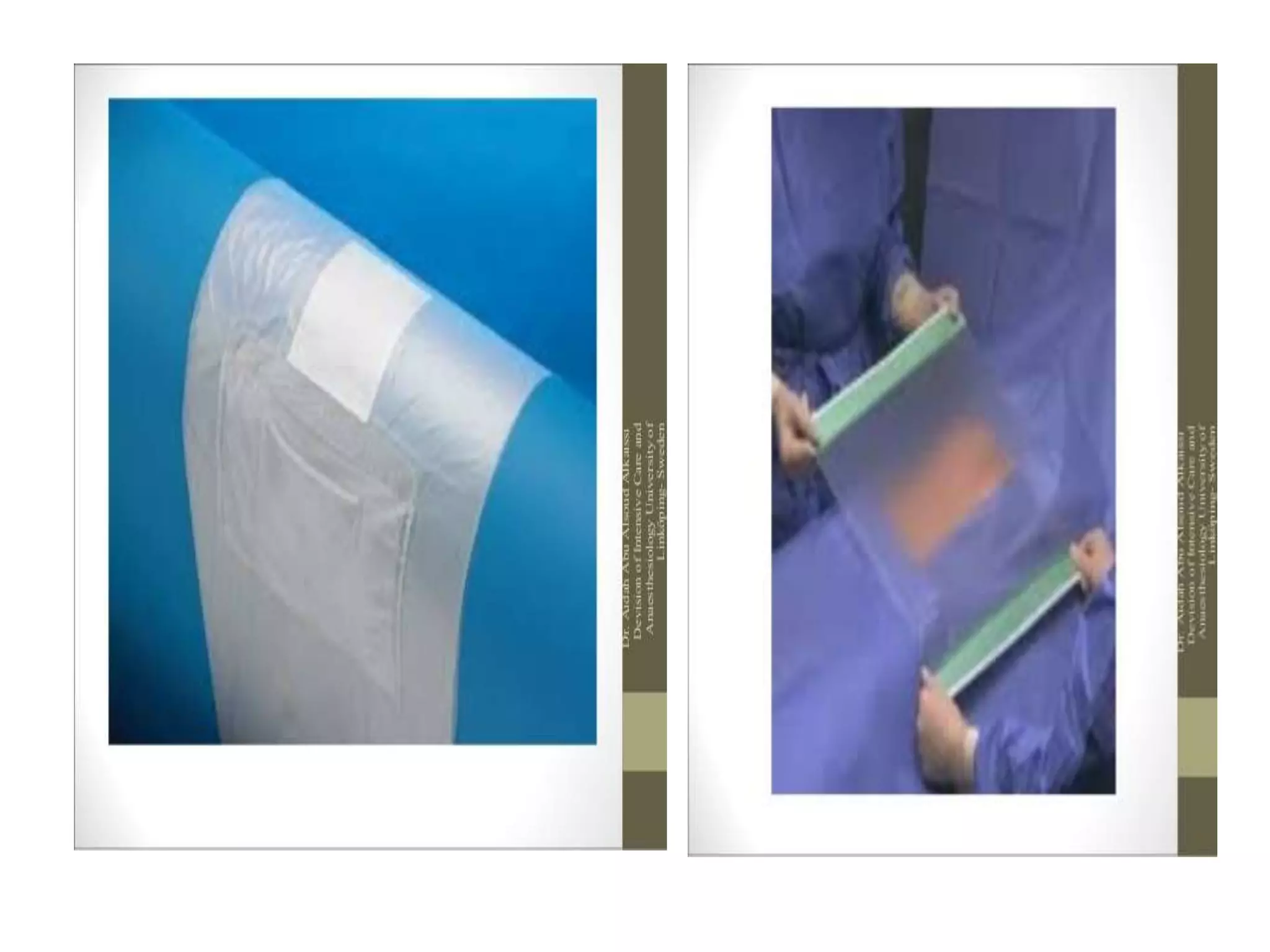 Surgical draping for technician | PPTX