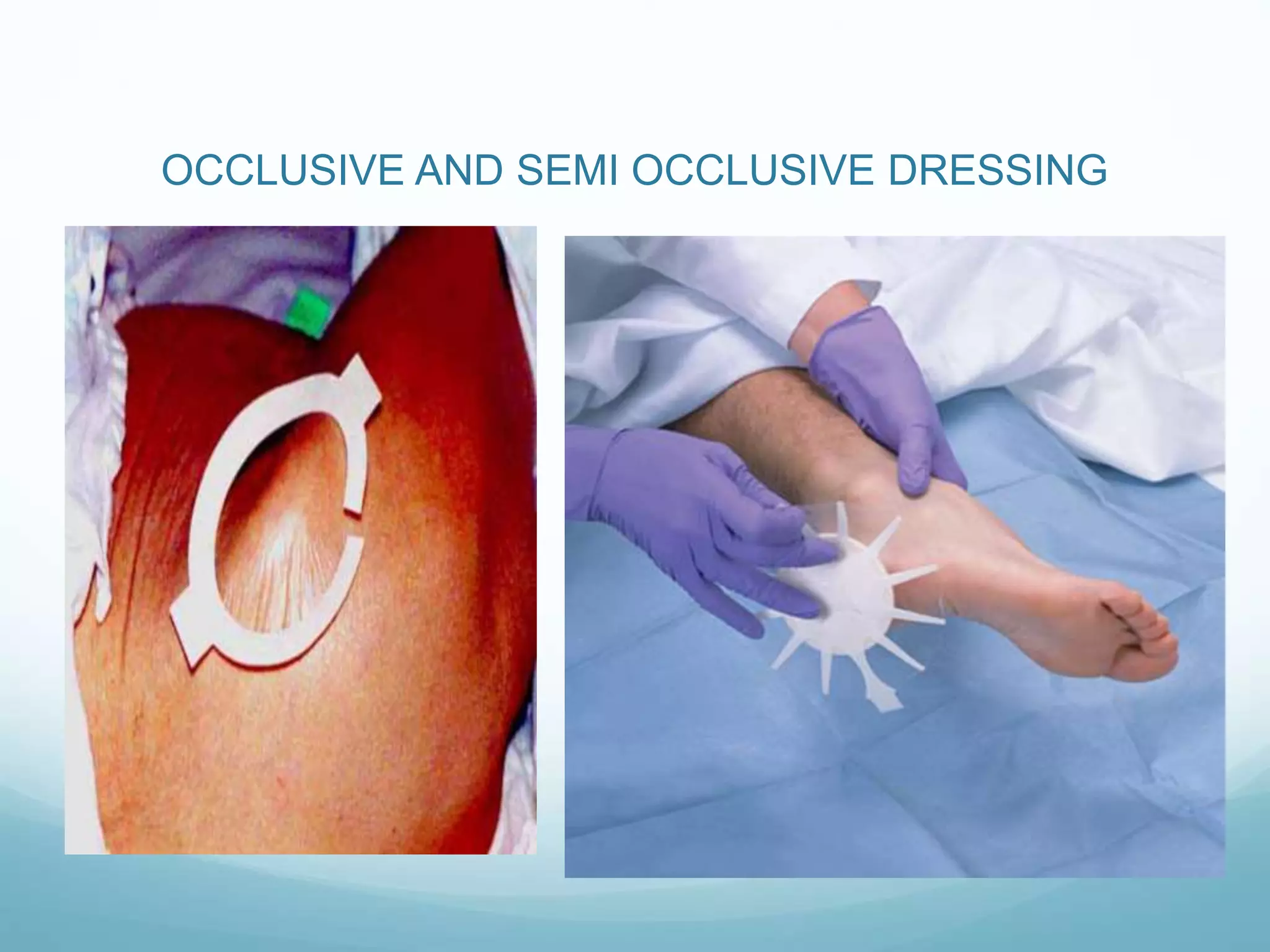 Surgical dressing | PPTX