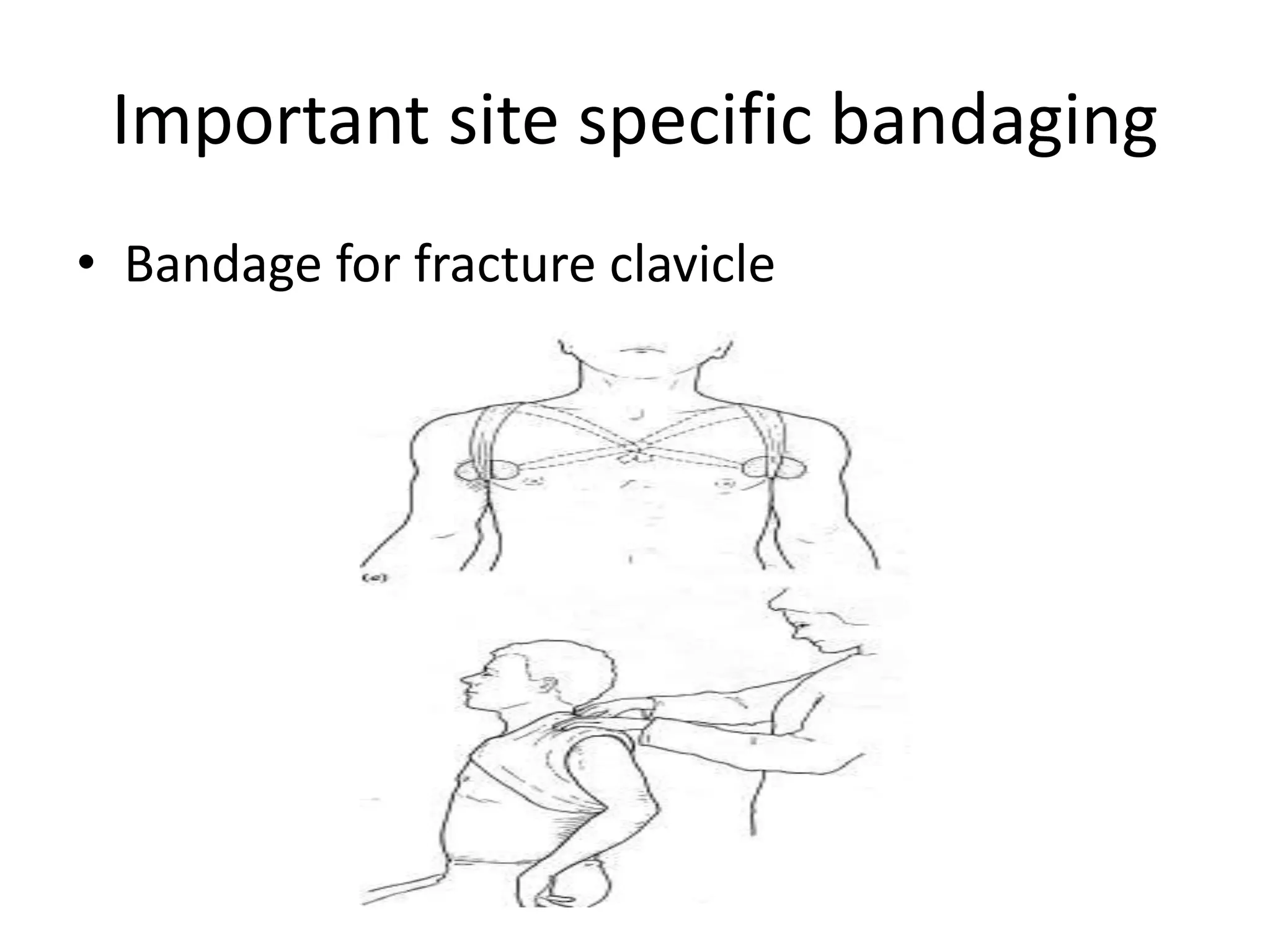 Surgical dressings ii | PPTX