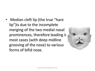 Surgical embryology in relation to common cranio facial /certified ...