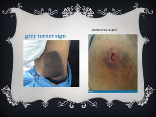 Surgical emergencies | PPTX