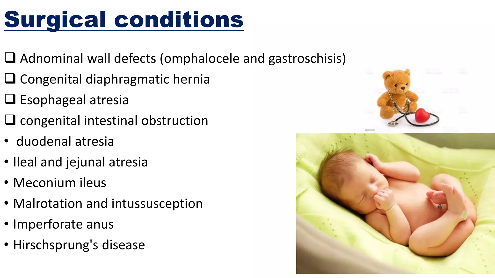 Surgical emergencies in the newborn | PPTX