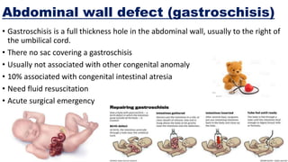 Surgical emergencies in the newborn | PPTX