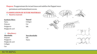 Surgical endodntics | PPT