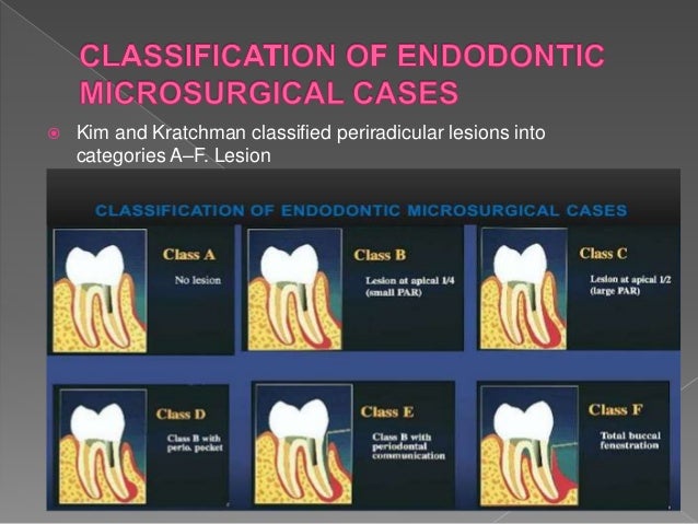 endodontic surgery and its current concepts