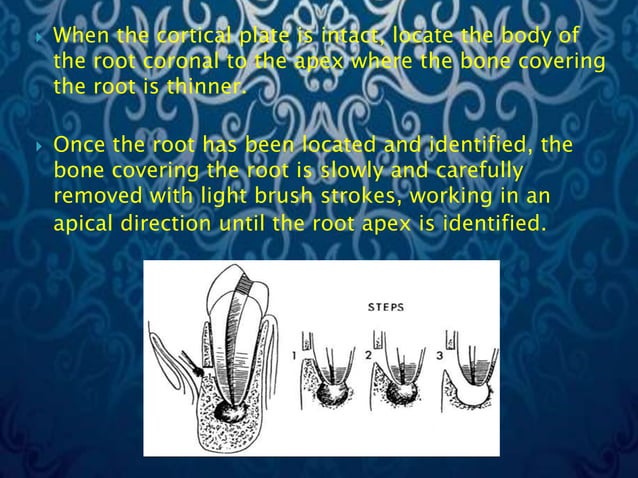Surgical endodontics (Apicectomy) by Dr. Amit T. Suryawanshi, Oral ...