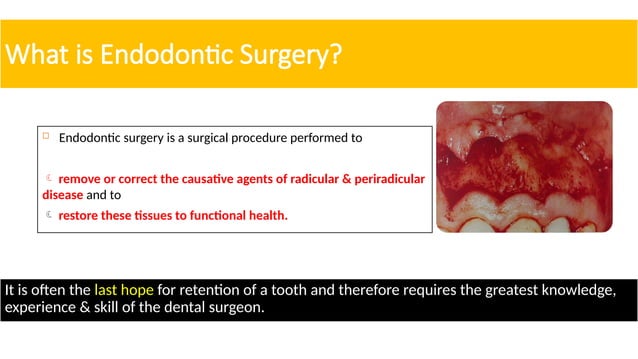 ppt on endodontic surgical procedures.pptx