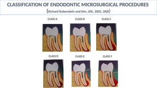 ppt on endodontic surgical procedures.pptx