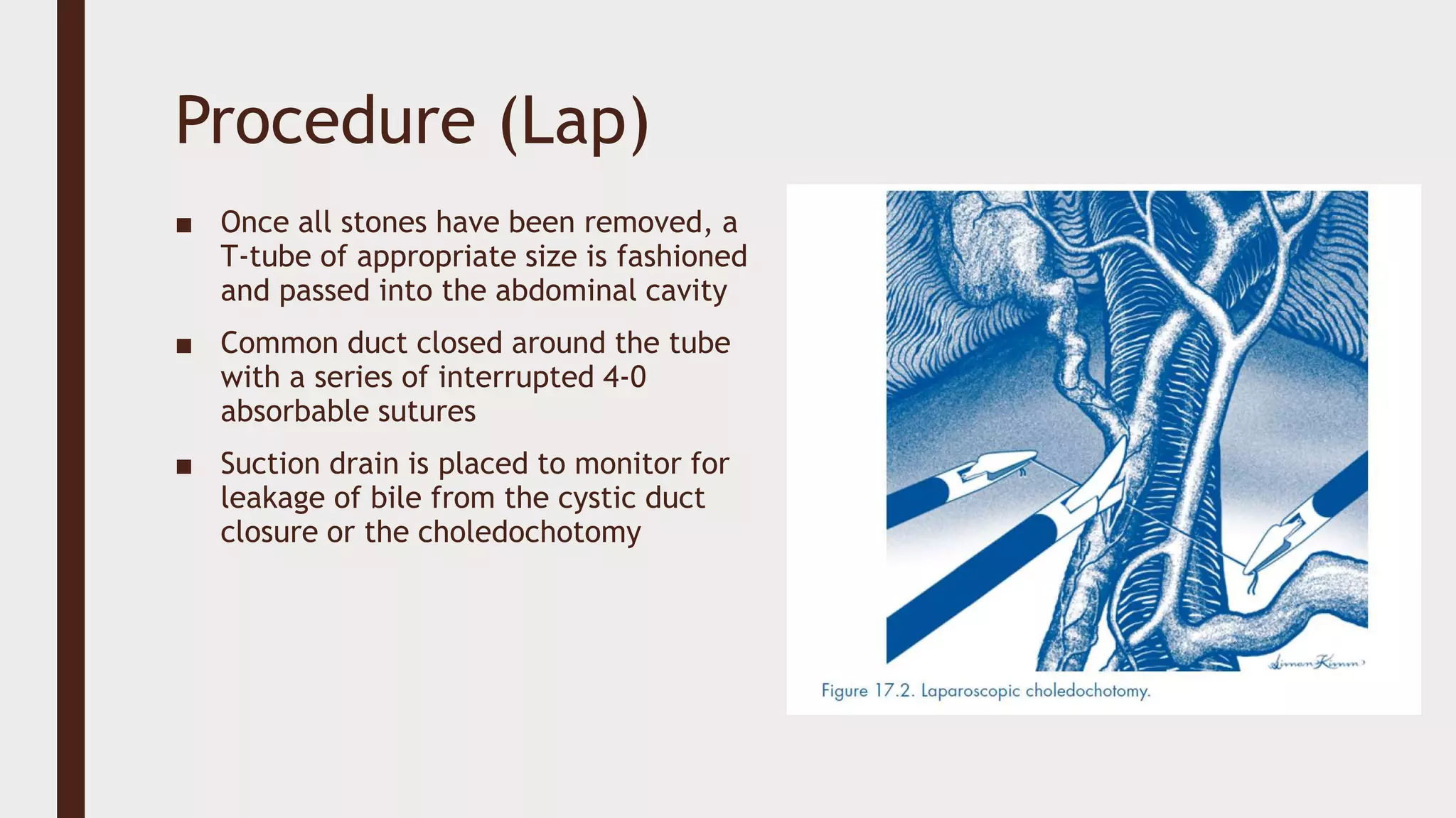 SURGICAL EXPLORATION OF THE COMMON BILE DUCT.pptx