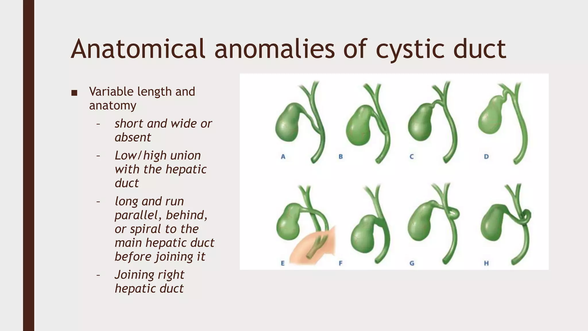 SURGICAL EXPLORATION OF THE COMMON BILE DUCT.pptx