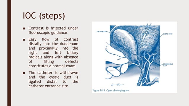 SURGICAL EXPLORATION OF THE COMMON BILE DUCT.pptx | Digestive Disorders ...