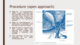 SURGICAL EXPLORATION OF THE COMMON BILE DUCT.pptx