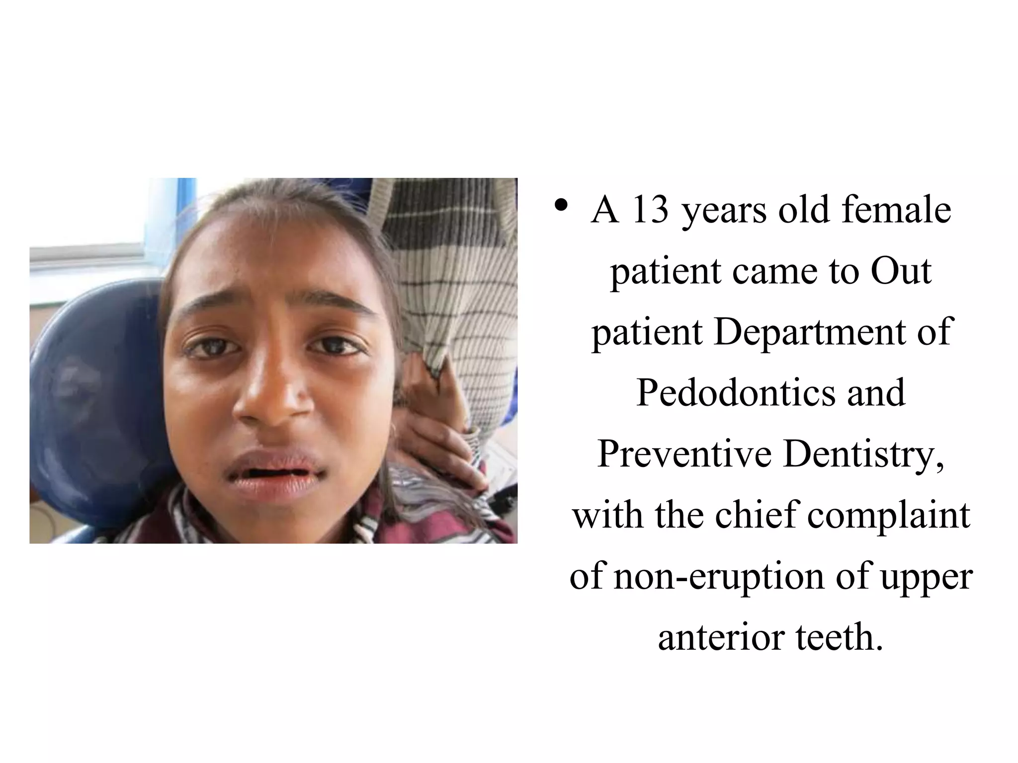 Surgical extraction dilacerated tooth | PPTX