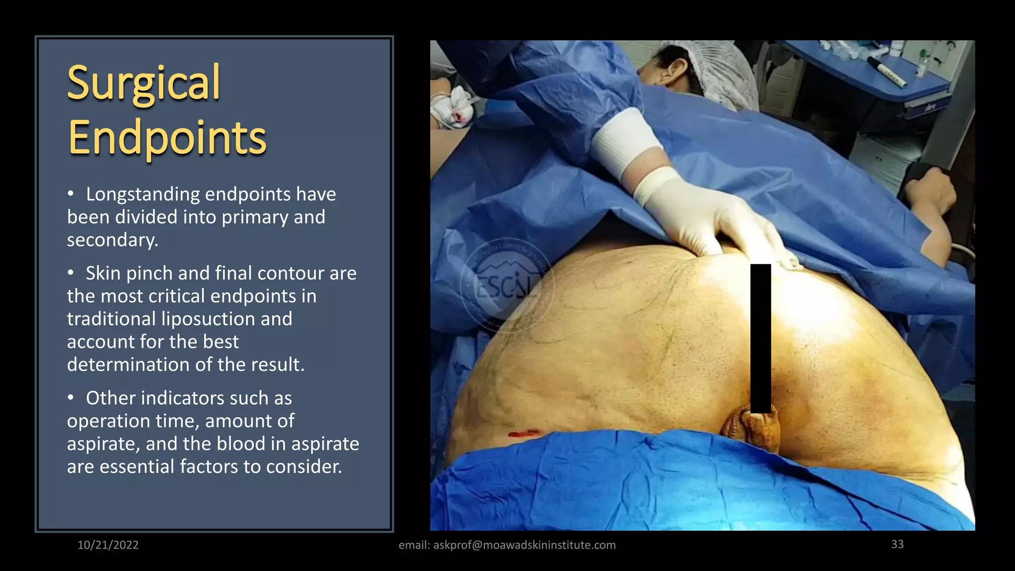 Surgical Fat Reduction (liposuction). Part II.pptx