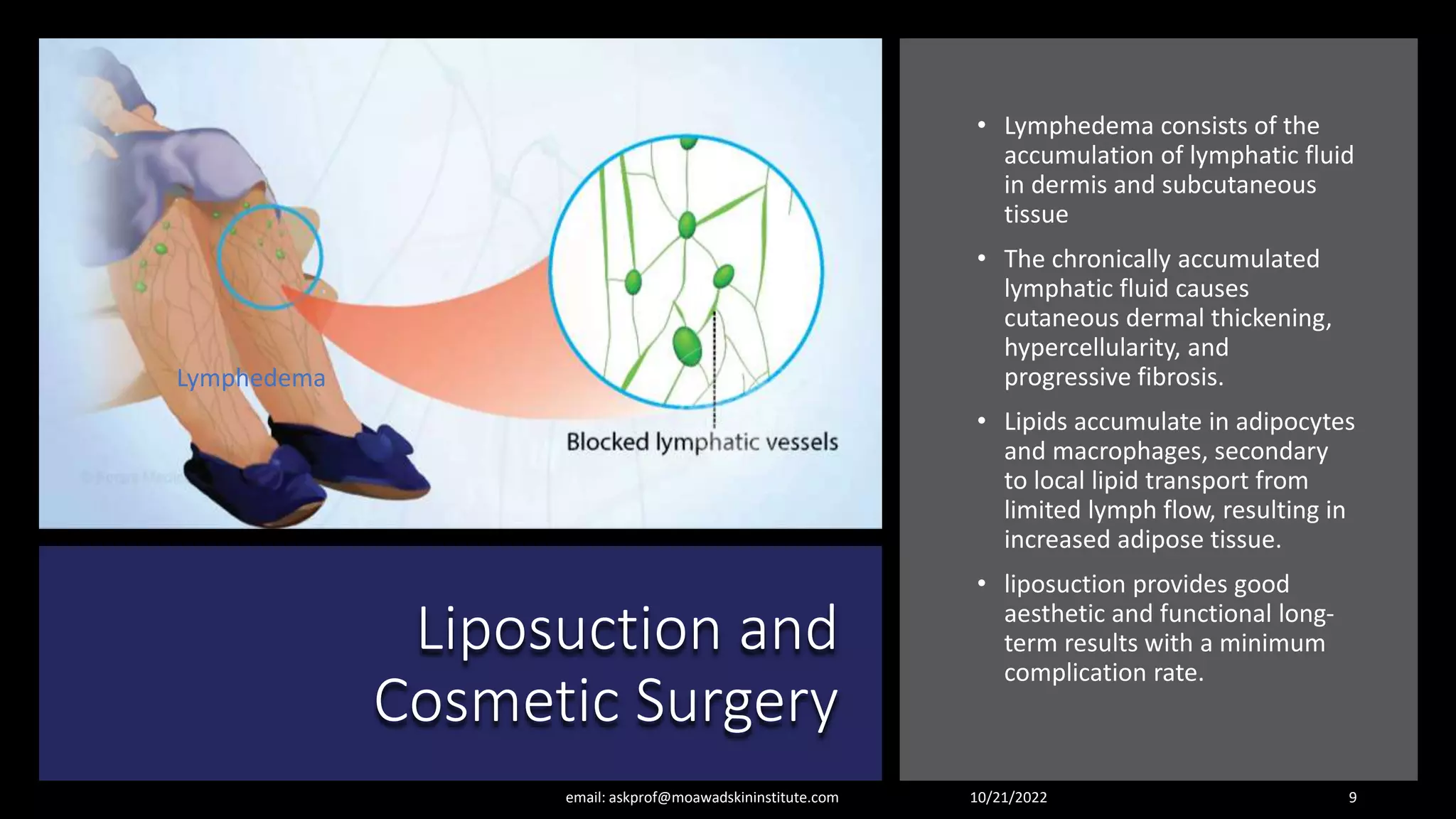 Surgical Fat Reduction (liposuction) Part I.pptx