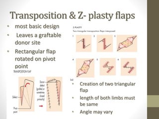 Surgical flaps | PPTX | Skin and Dermatology | Diseases and Conditions