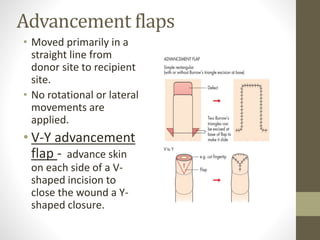 Surgical flaps | PPTX | Skin and Dermatology | Diseases and Conditions