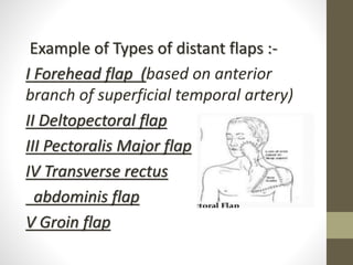 Surgical flaps | PPT