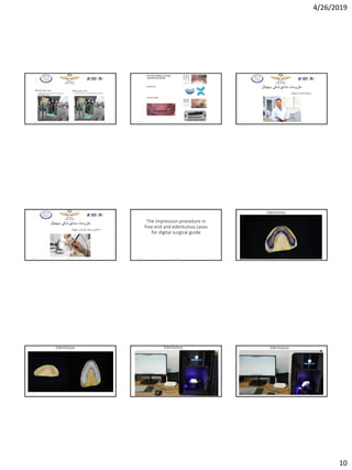digital Surgical guide final | PDF